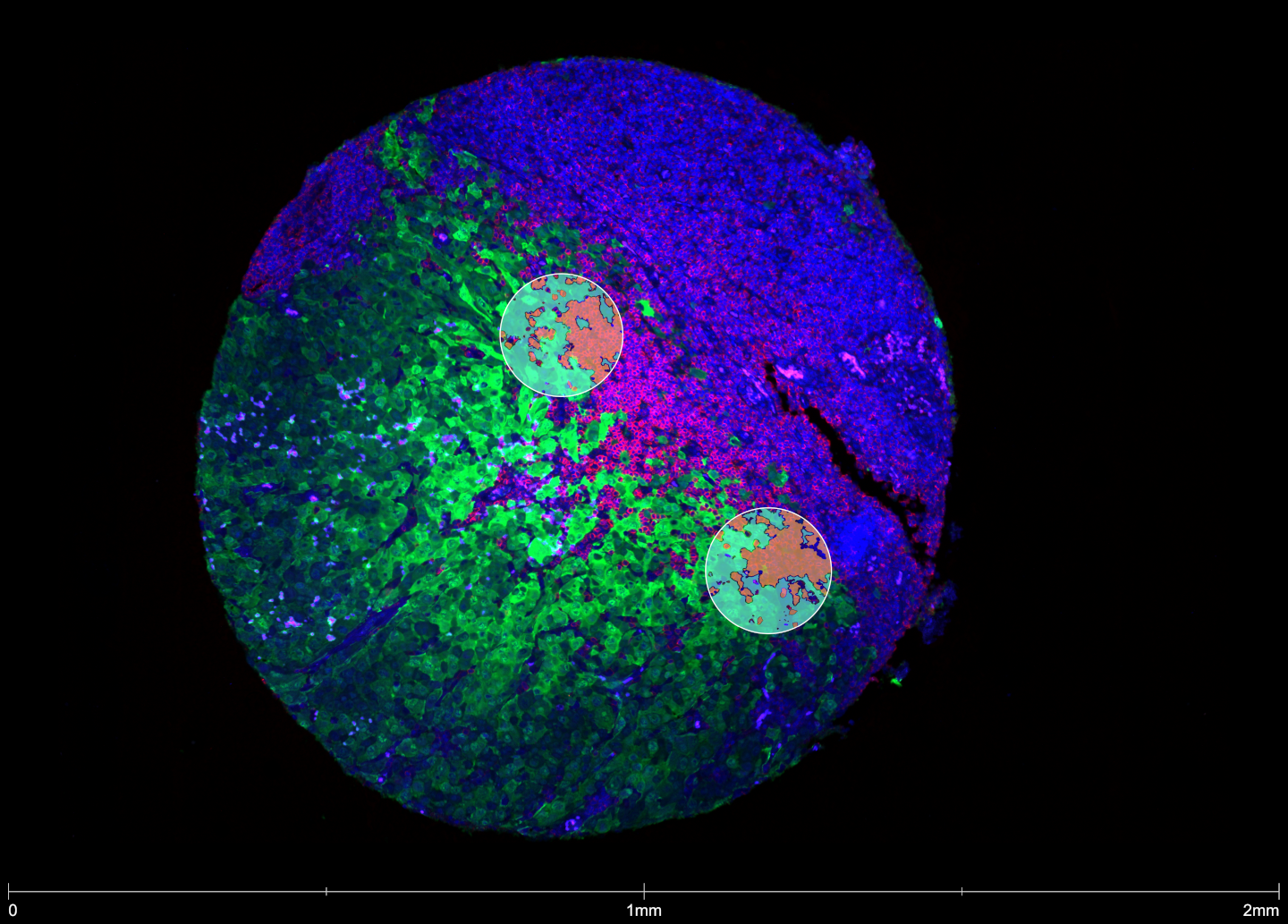 New and crucial role discovered for a protein in the body's immunity ...